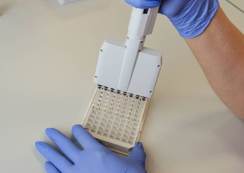 Human Serum & Plasma Samples | iSpecimen