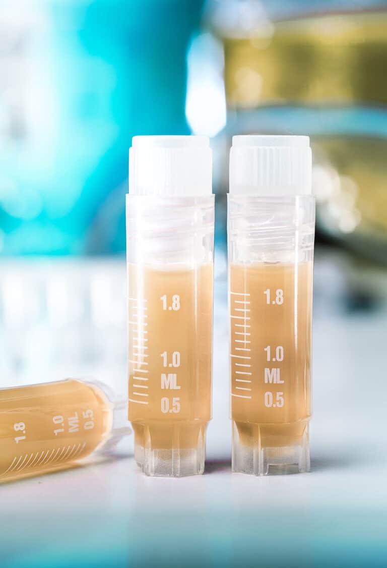 Human Bone Marrow Mononuclear Cells (BMMCs) | iSpecimen