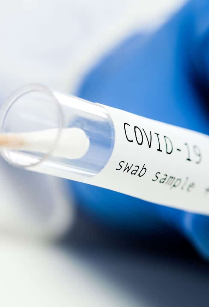 COVID-19 Samples for Research | iSpecimen