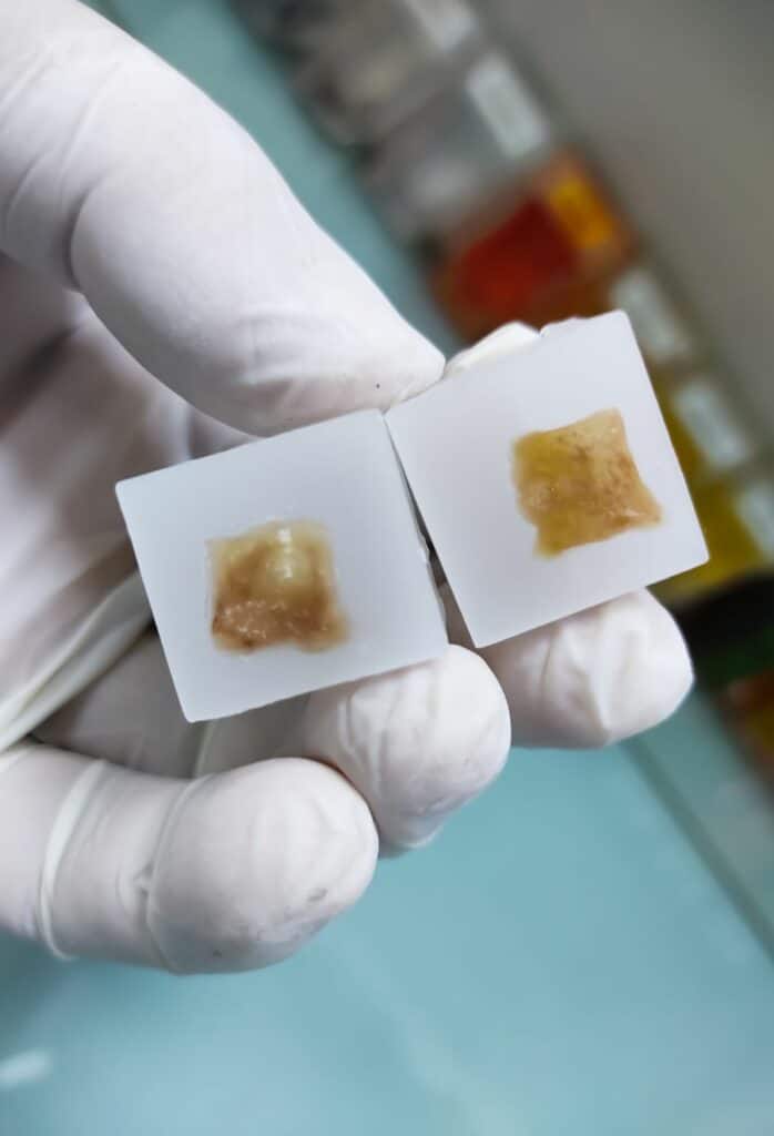 Cancer Tissue Samples, Biofluids and More | iSpecimen