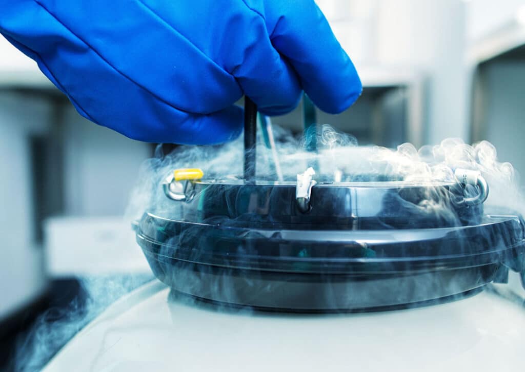 Human Sputum Samples | iSpecimen