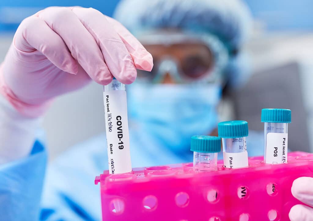 Human Saliva Samples | iSpecimen