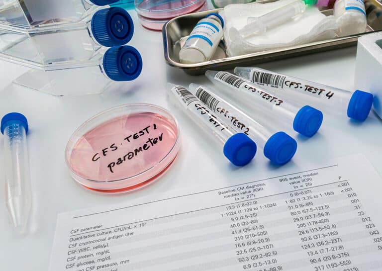 Human CSF Samples | iSpecimen