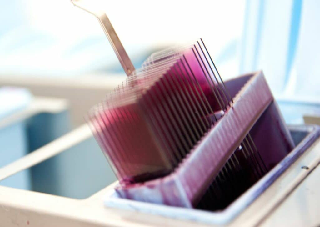 Cancer Tissue Samples, Biofluids and More | iSpecimen