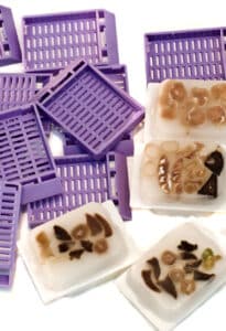 Human Tissue Samples | iSpecimen