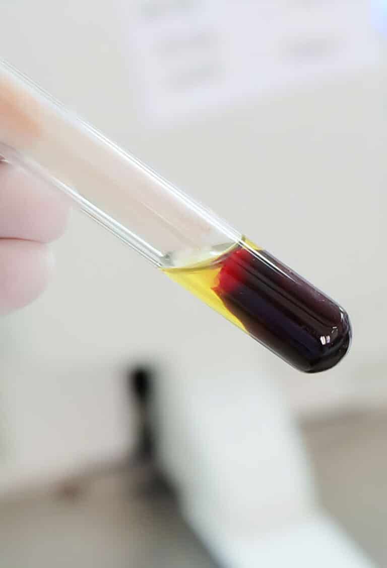 Human Serum & Plasma Samples | iSpecimen