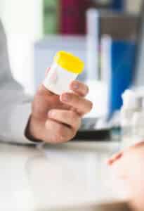 Human Urine Samples | iSpecimen