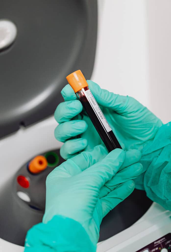 Human Biofluids | iSpecimen