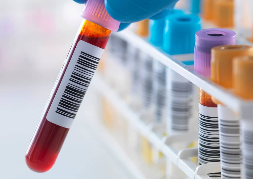 Specimens for Women’s Health Research | iSpecimen